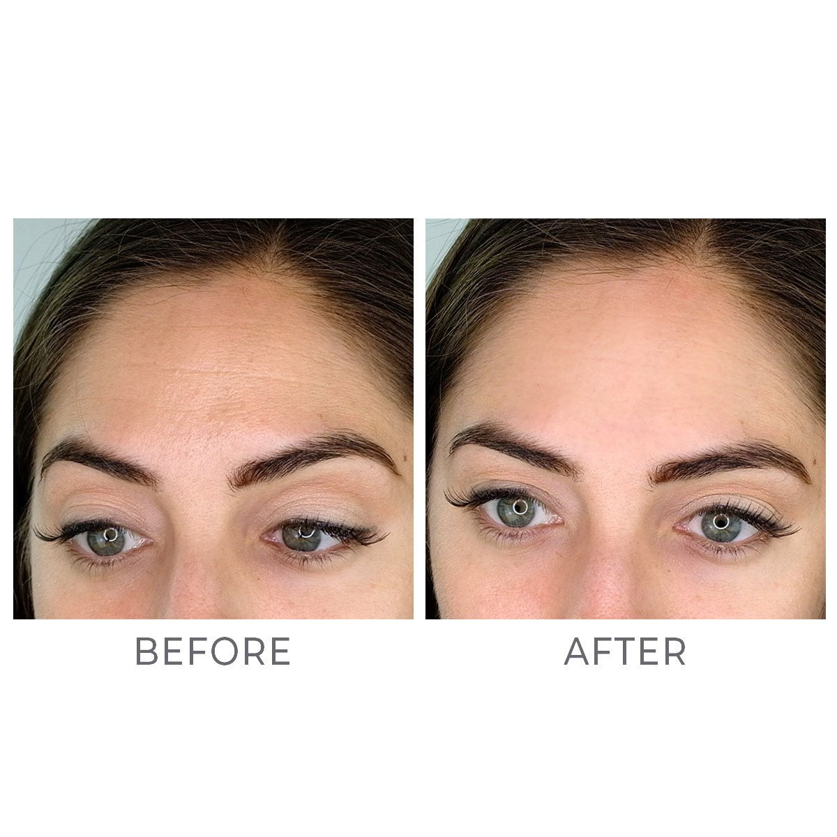 Line Smoother + Primer with Neodermyl® | Beautyque NYC